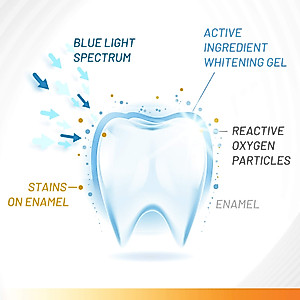 White Glo Accelerator Teeth Whitening Refill Gel for Sensitive Teeth and Gums, 3 Months of Professional Treatment, Carbamide Peroxide, Papaya, Pineapple Enzyme for Best Teeth Whitening Results - 3.4oz