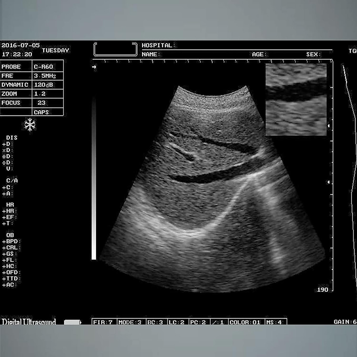 Veterinary Ultrasound Handheld Scanner with 3.5MHz Convex Probes Portable Ultrasound Machine for Pregnancy Animals Horse Pig Sheep Dog Cat Use