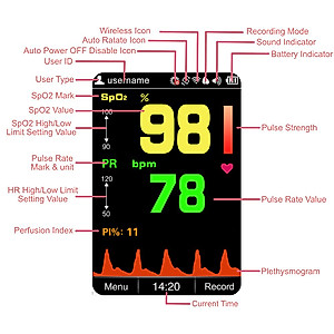 Viatom Handheld Pulse Oximeter for Adults, Up to 580 Hours of Storage Data Accurate SpO2 & Pulse Rate