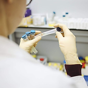 ULTECHNOVO 10pcs Conical Centrifuge Tubes 15ml Glass Test Tubes with Screw Cap for Laboratory Non - pyrogenic DNase/RNase - Free Human DNA - Free