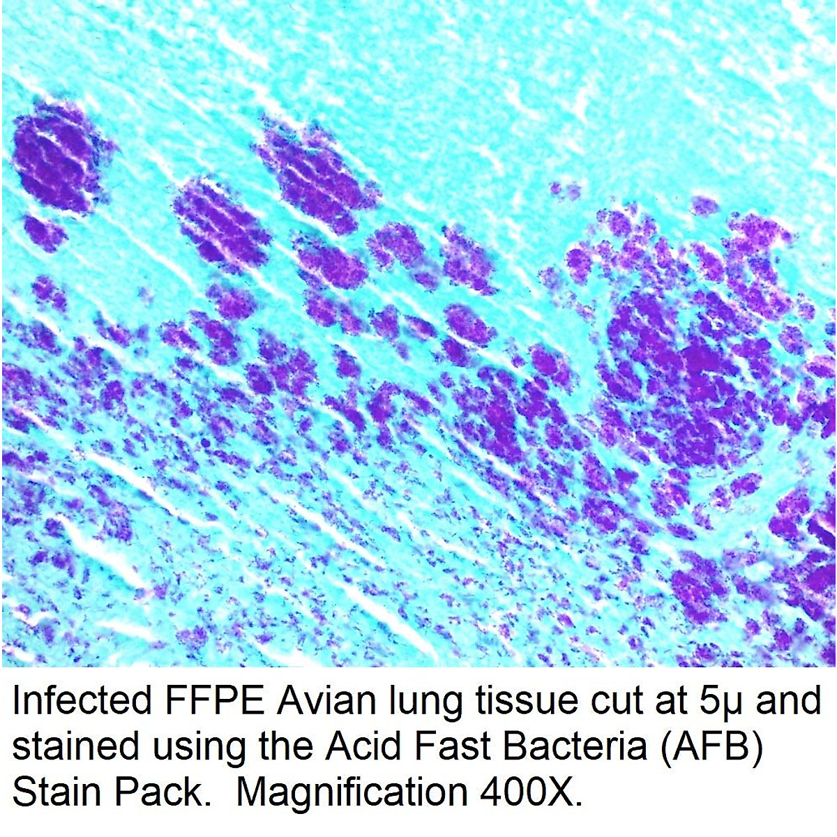 Acid Fast Bacteria (AFB) Stain Pack, 1000ml
