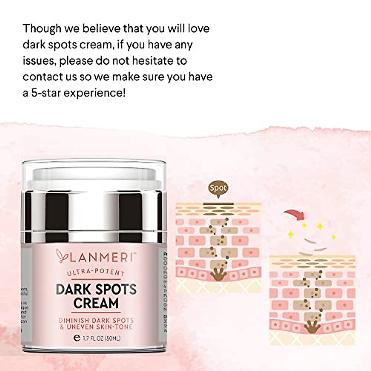 Lanmeri Dark Spot Remover for Face and Body, Dark Spot Corrector Fade Cream, Age Spot, Brown Spot, Sun Spot & Freckle Remover for Face, Hands and Other Body Areas, for Both Women and Men, for All Skin Types