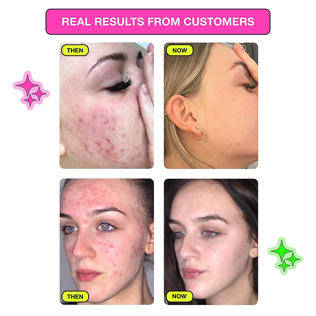 Carbon Theory | Charcoal & Tea Tree Oil Facial Cleansing Bar in Resealable Travel Pack | 100g