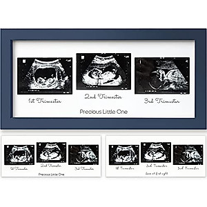 Sonogram Picture Frame - Trio Ultrasound Picture Frames For Mom To Be Gift - Baby Ultrasound frame - Pregnancy Announcements Sonogram frame - Baby Nursery Decor, Pregnant Mom Gifts (Midnight Blue)