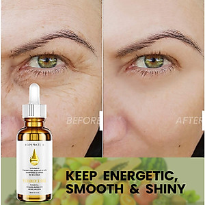 HOPEMATE H Vitamin E Oil - Anti Aging, Reduce Wrinkles and Fine Lines for Moisturized & Youthful Skin - Pure & Natural Vitamin E Serum for Face, Hair, Nails (1 oz)