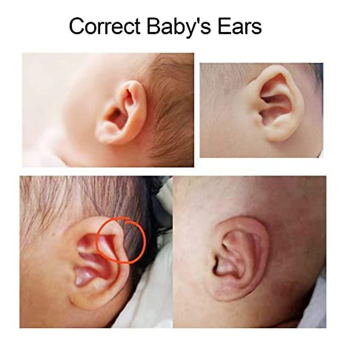 Baby Auricle Valgus Correction Patch, Silicone Ear Aesthetic Corrector, Newborn Baby Ear Aesthetic Correctors, Kids Infant Protruding Ear Patch Stickers, Baby Silicone Gel Ear Tape 4cmx50cm