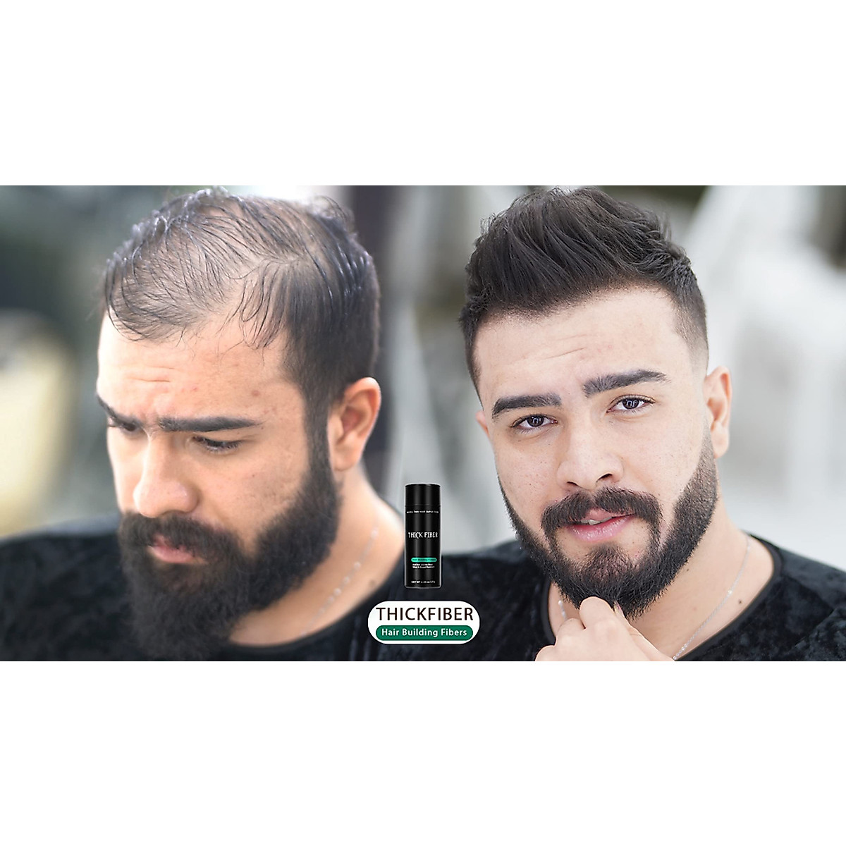 THICK FIBER Hair Fibers for Thinning Hair & Bald Spots (BLACK) - 25g Bottle - Conceals Hair Loss in Seconds - Hair Powder for Women & Men