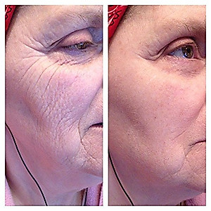 Instanly Ageless - Anti Wrinkle 5 Vials (.6mL Each)