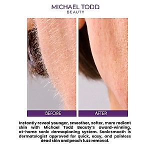 Michael Todd Sonicsmooth Replacement Kit for At-Home Dermaplaning