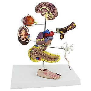 Teaching Model, Anatomy Model, Human Anatomy - Pathological Diabetes Model Diabetic Organ Anatomical Model, Complication Cerebral Pancreatic Neuron Surgery - Medical Educational Training Aid, 8 Parts