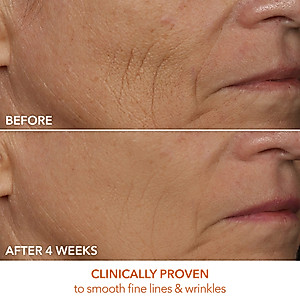 Dr. Dennis Gross DRx SpectraLite FaceWare Pro – LED Face Mask for Anti-Aging, Acne Treatment, and Skin Rejuvenation with Dual Red & Blue Light Therapy