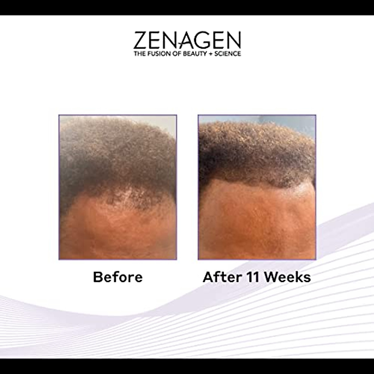 Zenagen Revolve Thickening Hair Loss Treatment for Men, 6.75 Fl Oz