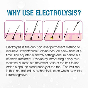 Clean + Easy Non-Laser Personal Electrolysis Device - Permanent Hair Removal for Face and Body, Battery Operated, Painless and Convenient Home Treatment