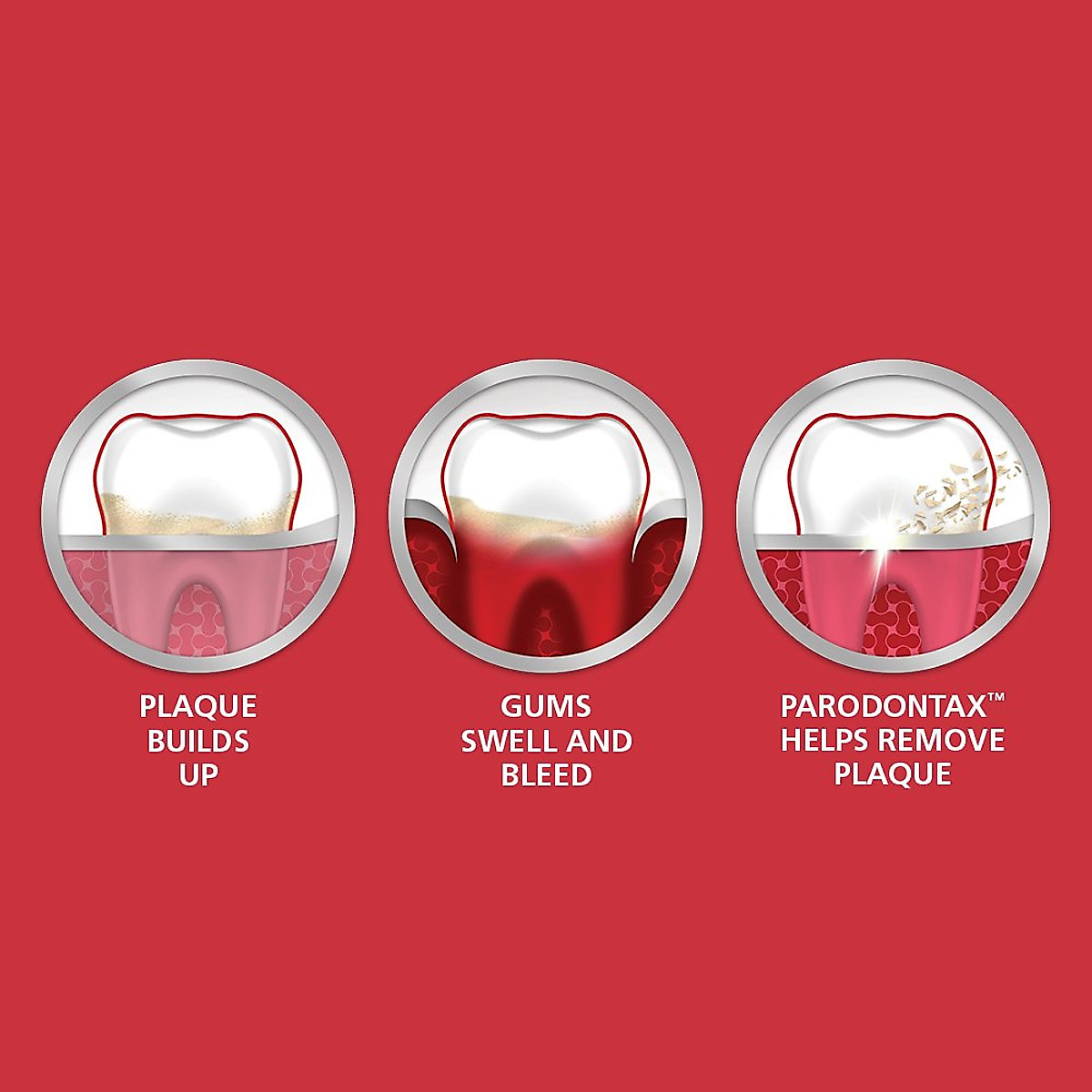 Parodontax Toothpaste for Bleeding Gums, Gingivitis Treatment and Cavity Prevention, Clean Mint - 3.4 Ounces