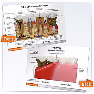 Dental Model | Human Body Anatomy Replica of Teeth w/Common Pathologies for Dentist Office Educational Tool | GPI Anatomicals