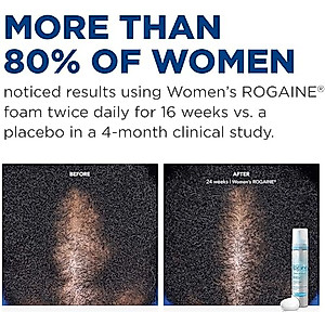 Rogaine 5% Minoxidil Foam, Topical Once-A-Day Hair Loss Treatment for Women to Regrow Fuller, Thicker Hair, Unscented, 2-Month Supply, 2.11 oz
