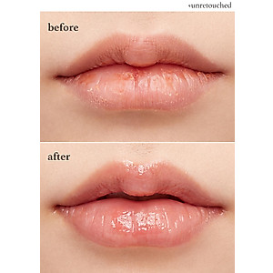 NOONI Korean Lip Butter Overnight Melting Balm (Applebutter) Lip Mask, with Shea Butter and Vitamins | Hydrating, Nourishing, Lip Balm, Soothing, Moisturizing, Softening, Korean Skincare