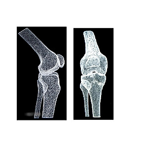 Blue Tree Publishing Knee Joint 3d Laser Key Chain Crystal, Anatomy, Bone, Physical Therapy Sports