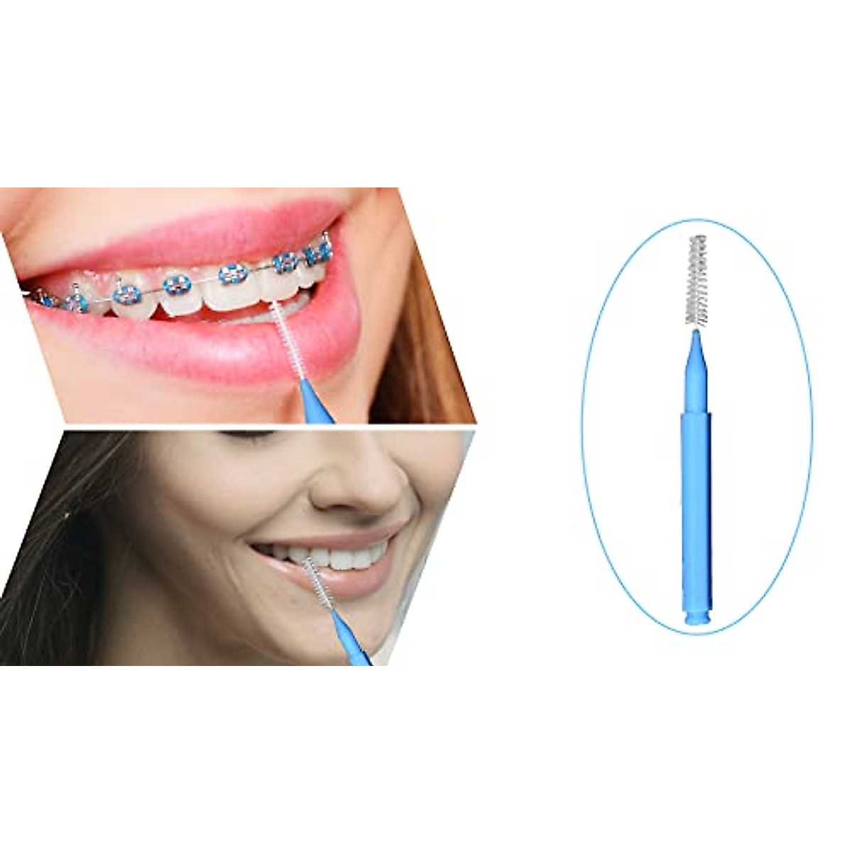 GOUWEIBA 100pcs Braces Brush Disposable Interdental Brush Toothpick Dental Tooth Flossing Head Oral Dental Hygiene Flosser Dental Hygiene Flosser Tooth Cleaning Tools Oral Flossing Head (Mixed Color)