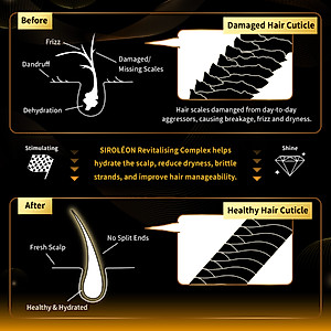 SIROLÉON Biotin Shampoo and Conditioner Set for Thinning Hair and Hair Loss, Hair Thickening Formula with Saw Palmetto Extract & Natural Smelling, For Men and Women, Silicon Free, 16.9 fl oz