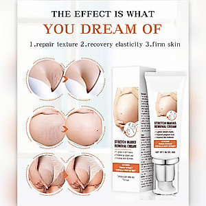 Stretch Mark Cream, Scar Cream Removal Cream Scars Essence Stretch Mark Repair Cream Stretch Scars Remove Acne Cream Stretch Mark Treatment Maternity Repair