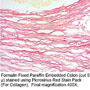 Picrosirius Red Solution, 500ml