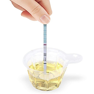 PPX 100 Pack Urine Cups,Plastic Disposable Urine Specimen Cups for Ovulation Test/Pregnancy Test/pH Test Etc. 40ML/1.36 oz