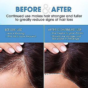 Biotin Hair Growth Shampoo And Conditioner For Women And Men With DHT Blockers, Shampoo and Conditioner For Thinning Hair and Hair Loss, Paraben Free, Sulfate Free, 16 oz. (473 ml) Bottles