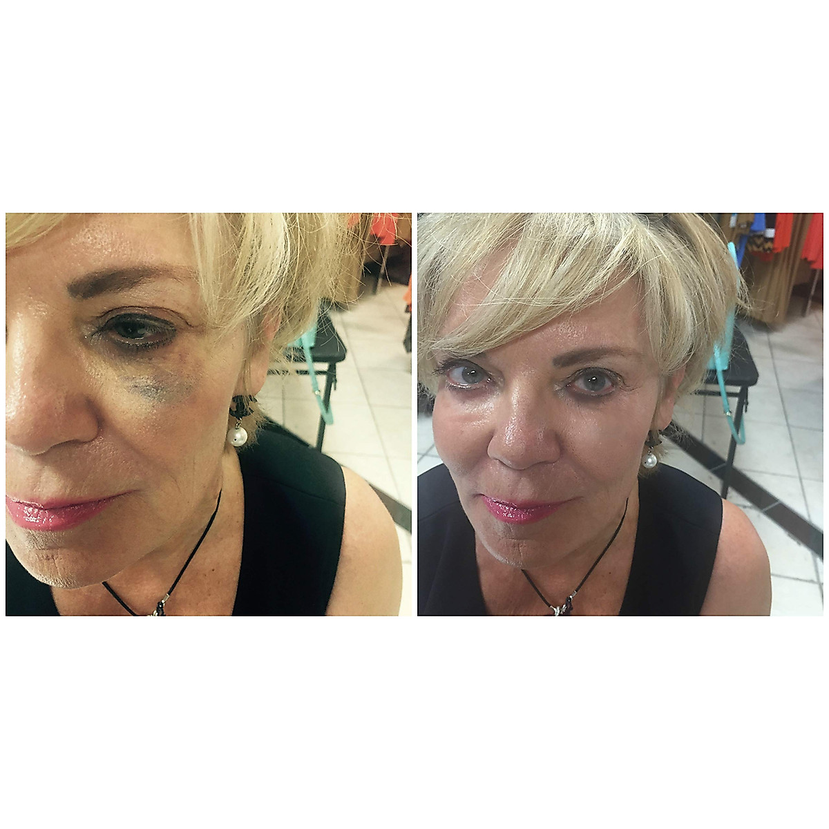 Judith August Killer Cover - Light/Medium - Cover Bruises, Tattoos, Age Spots, Vitiligo & More