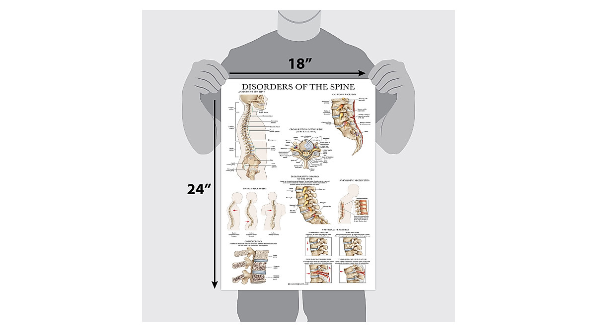 Palace Learning Spine Anatomy Poster - Laminated Spinal Chart | 18x24"