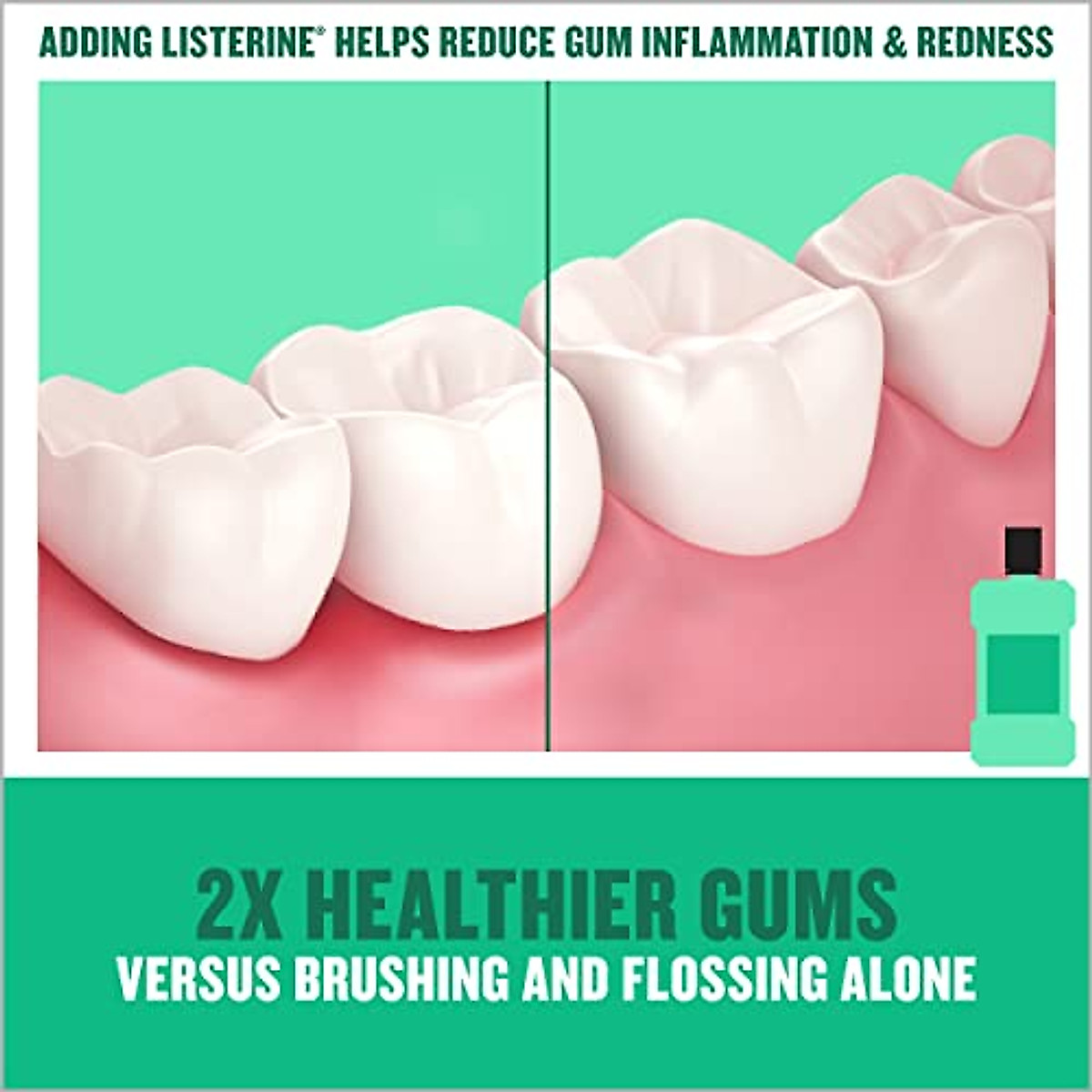 Listerine Freshburst Antiseptic Mouthwash for Bad Breath, Kills 99% of Germs That Cause Bad Breath & Fight Plaque & Gingivitis, ADA Accepted Mouthwash, Spearmint, 1 L, Pack of 2