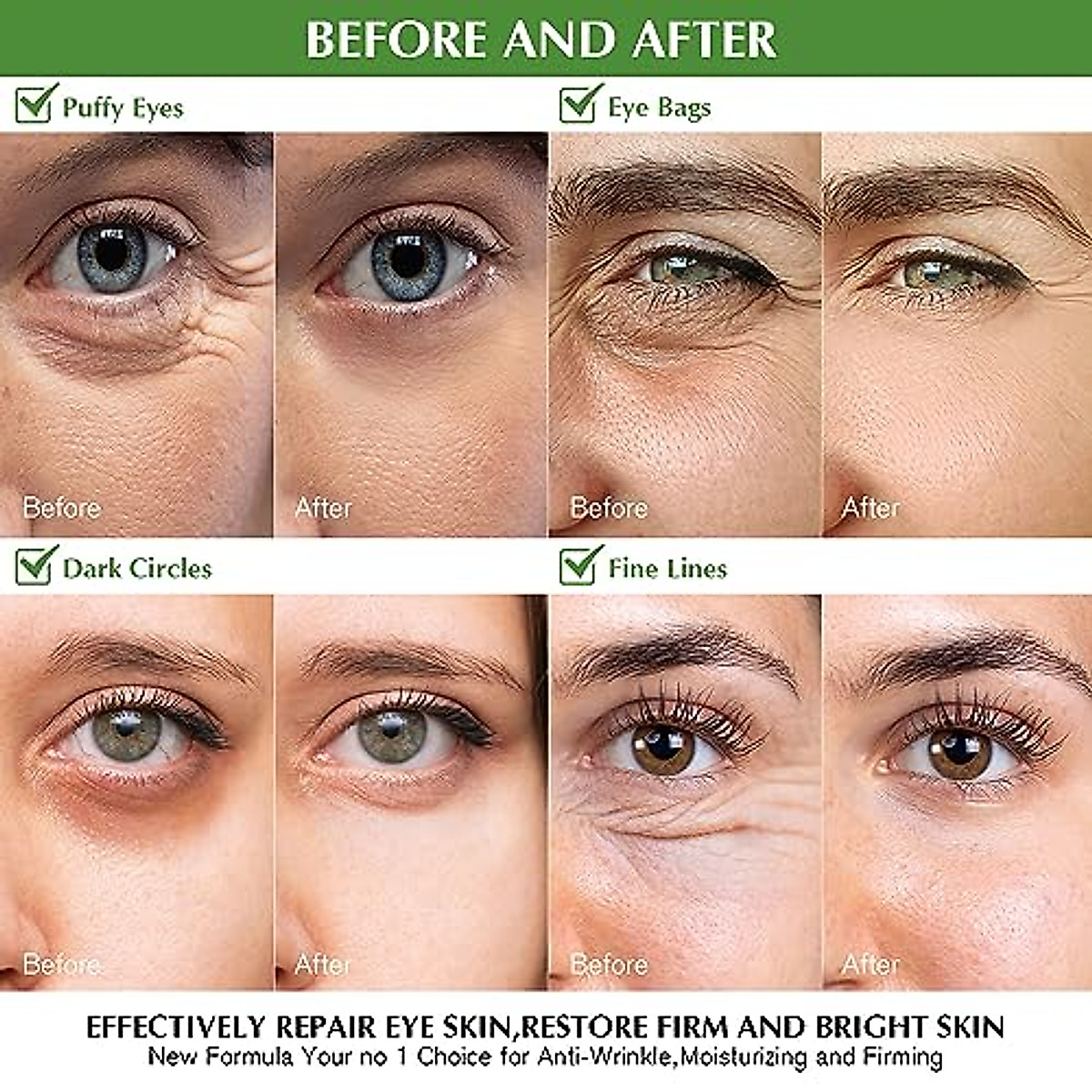 Enaskin Naturals Under Eye Patches - Green Tea Under Eye Masks for Dark Circles And Puffiness, Collagen Eye Gel Pads Moisturizing & Reducing Wrinkles, Beauty & Personal Eye Skin Care Products (30 Pairs) (Green)