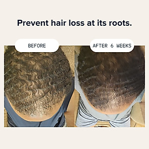 CARDON Hair Growth Set - Strengthening Shampoo and Conditioner for Men, Boost Hair Growth and Prevent Thinning, Korean Haircare for Healthy Scalp and Deep Conditioning (2 Bottles)