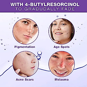 Dark Spot Remover for Face - Dark Spot Corrector Serum for Sun Spot Brown Spots Stubborn Spots-Freckle Remover - Melasma Hyperpigmentation Treatment Formulated with 4-Butylresorcinol, Kojic Acid and Hyaluronic acid- 50 ml