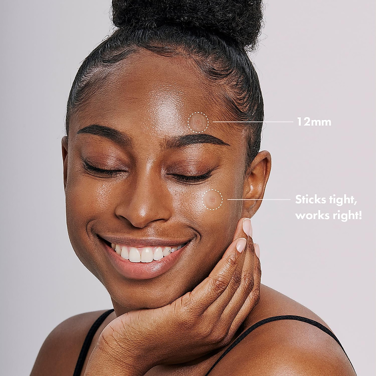 Acropass Trouble Care Microcone Acne Patch for Early Stage Pimple and Zits - Hydrocolloid, Niacimide Pimple Spot Treatment (6ct + 6 Tea Tree cleansers)