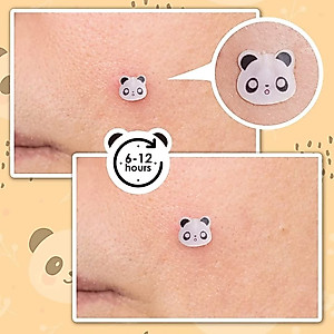 AUSLKA Panda Pimple Patches- 120 Patches, Hydrocolloid Spot Dots - Blemishes Patch - Facial Skin Care, For Zits, Blemishes, & Breakouts