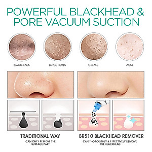 VOYOR Blackhead Remover Pore Vacuum - Electric Face Vacuum Pore Cleaner Acne White Heads Removal with Suction Heads (BR510)