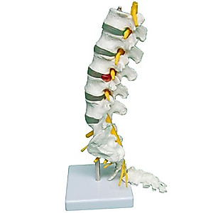 tinsay Anatomical Human Spine Model Consists of 5 Lumbar Vertebrae with Intervertebral Discs,Lumbar Nerves and Spinal Cord.