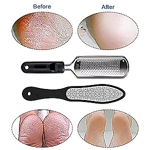 Oneleaf 2PCS Professional Pedicure Rasp Foot File Cracked Skin Corns Callus Remover for Extra Smooth and Beauty Foot (Black) (Black)