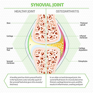 SSN Fluid Motion - Hyaluronic Acid for Dogs 30-60+ Day Supply - Liquid Joint Supplement for Senior Dogs - Apple Flavor - Hip & Joint Support, Mobility, and Comfort - Glucosamine Alternative (150ml)