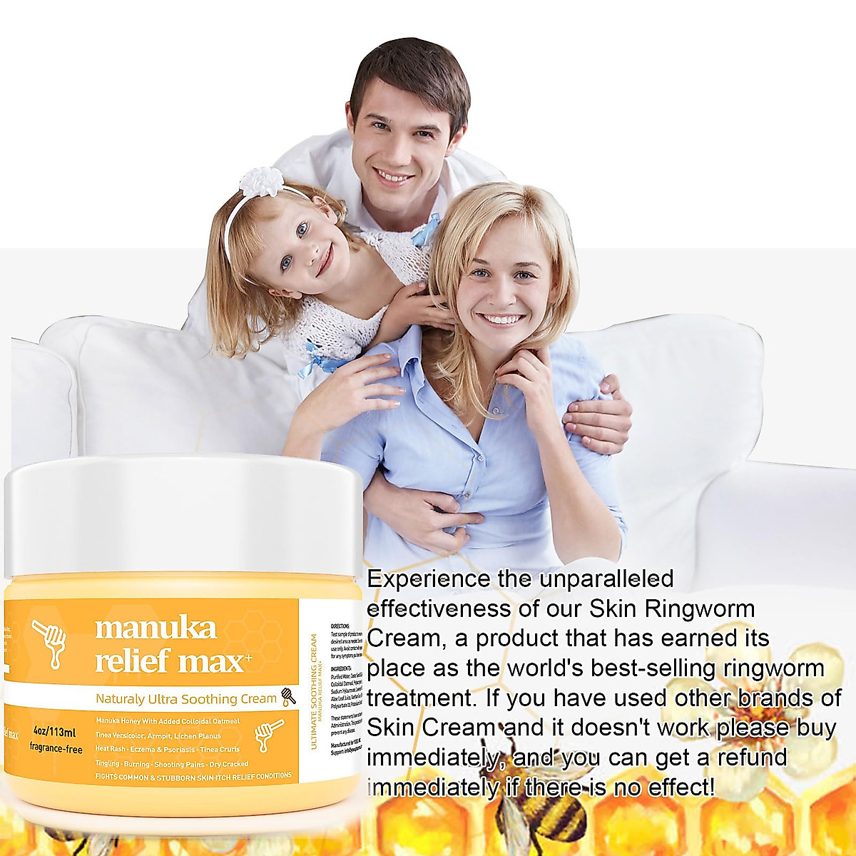 UEUEKOKO Eczema Psoriasis Manuka Relief Honey Cream, Hand Foot, Tinea Versicolor, Itchy Feet, Butt, Anal Itch, Scalp Dandruff, Bee Sting, Bites, Boil Cyst, Armpit, Adults Kids, Hidradenitis Treat