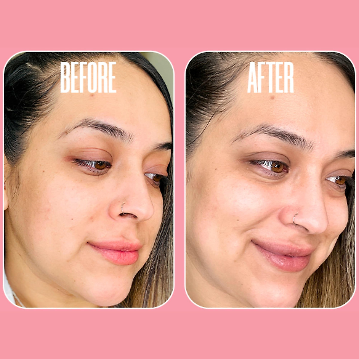 Glycolic Acid Pads with Vitamin C - Toner Pads for Face Cleansing With Tea Tree Oil - Exfoliating Pads with 20% AHA & Vitamins E, B3, B5 - Facial Peel Resurfacing Pads, Glycolic Acid Peel (50)