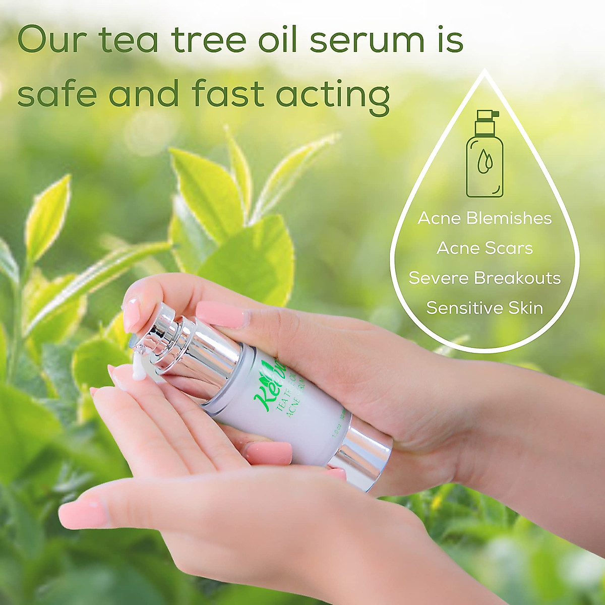 Tea Tree Oil Acne Serum - Perfect for Blemishes, Spots, Scars, Bacne, Pimples, Blackheads, Whiteheads with Natural & Organic Ingredients - by Keeva Organics