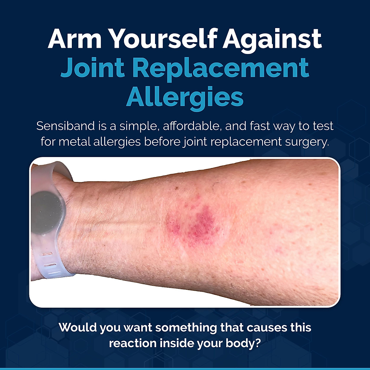 SENSIBAND Metal Allergy Test Band – Test at Home or Anywhere - Tests for Common Metals Used in Piercings & Jewelry - See Your Own Results - Order 3 Weeks Before Surgery.… (Copper)