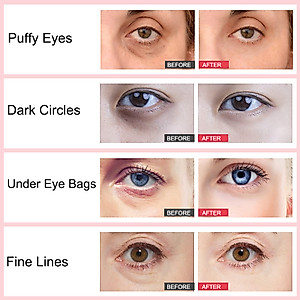 Retinol Eye Stick, Under Eye Cream, With Retinol, Hyaluronic Acid for Dark Circle and Puffiness, Retinol Eye Balm Reduce Wrinkles and Fine Lines, Bags Under Eyes.