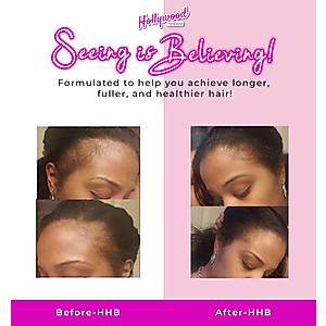 Hollywood Hair Bar Super Grow Scalp Balm - Revitalizing Scalp Balm, Vegan and Cruelty Free, 4 oz