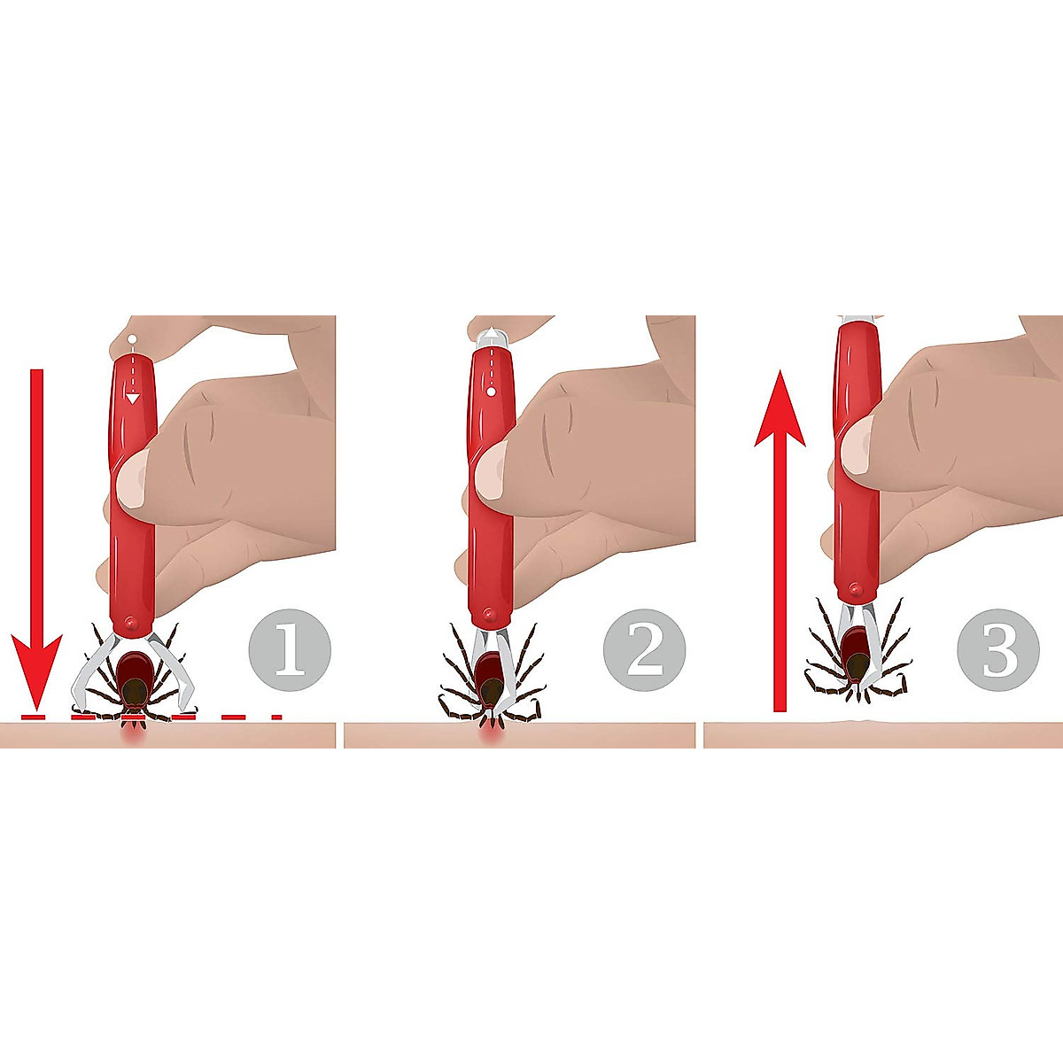 valonic tick Remover, 2 Pack - red, tick Removal Tool - tick Remover for Dogs and Cats