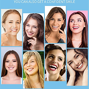 CHJC 2022 New Snap-On Dentures, Veneers Snap in Teeth, Snap in Teeth for Men and Women, Fix Confident Smile, White (CREAM)