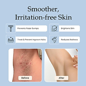 Razor Bump Stopper Solution for Ingrown Hair Skin Care Treatment for Face, Neck, Bikini Area, Legs and Underarm Area After Shave Serum Roll-On for Men and Women With Salicylic Acid, Glycolic Acid