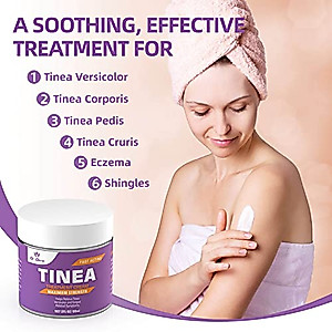 DR. DERM Tinea Versicolor Treatment, Antifungal Cream for Tinea Versicolor & Pedis, All-Natural Athletes Foot Treatment Ringworm Treatment for Humans, Fast Healing Anti Fungal Skin Cream